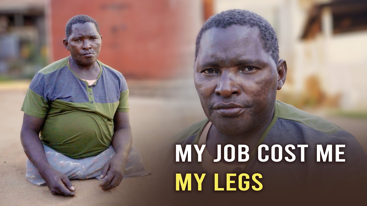 My Job Cost Me My Legs: From Walking to Wheelchair - YouTube