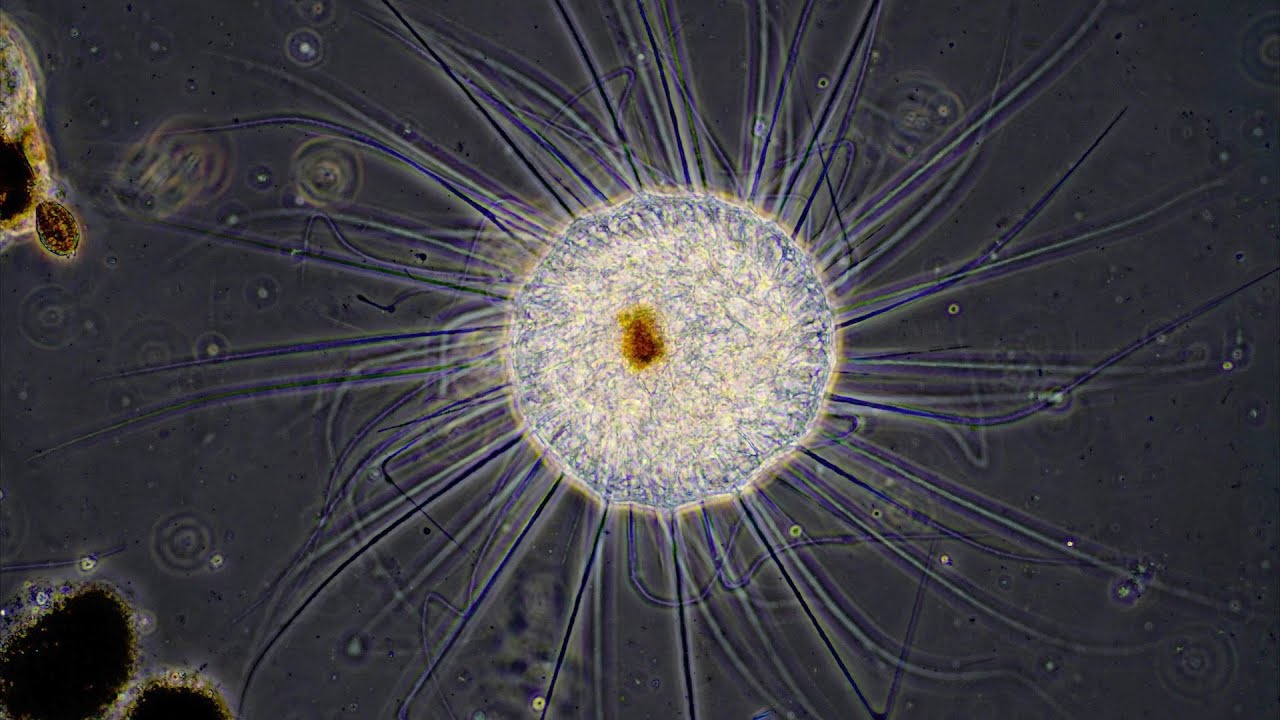 Death Star vs Animal! Heliozoan hunting Rotifer - YouTube