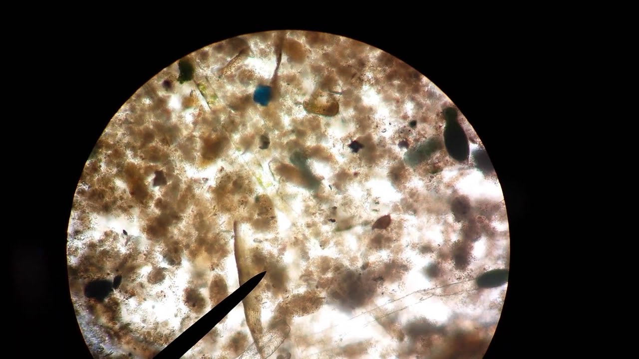 aquatic microscopic large worm and colpidium #1 - YouTube