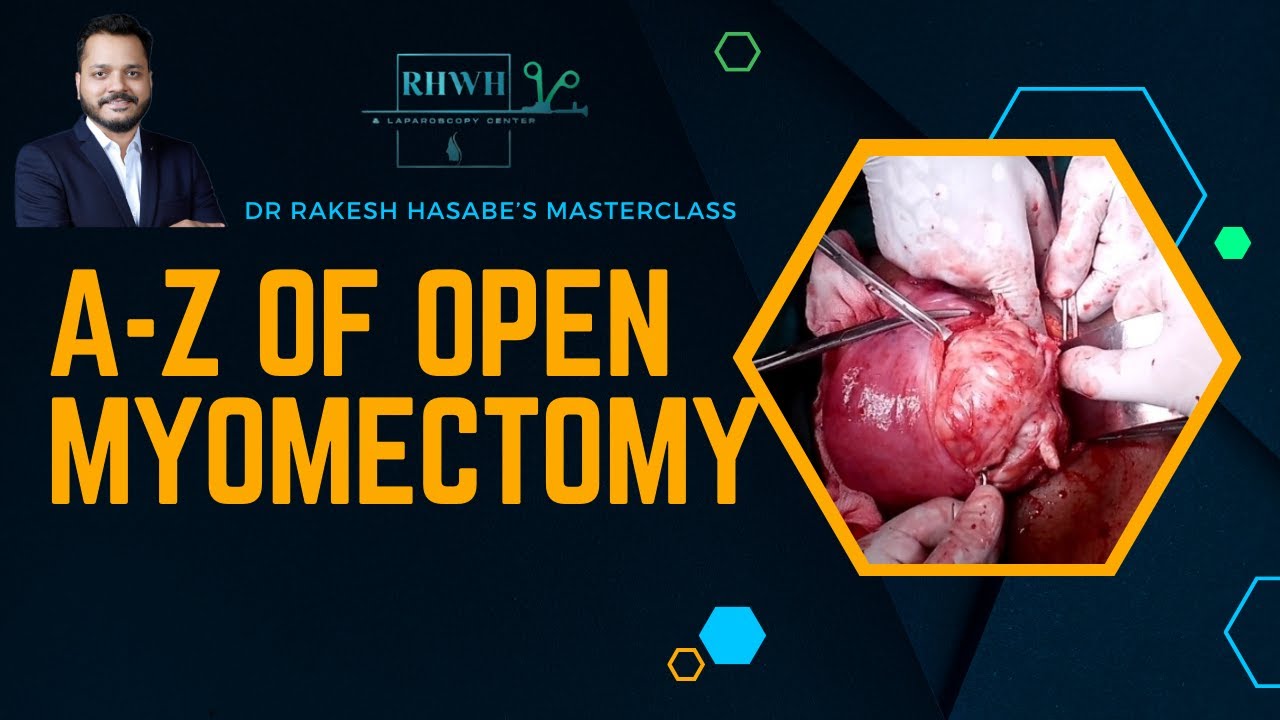 128 : MASTERCLASS : A-Z OF OPEN MYOMECTOMY - YouTube