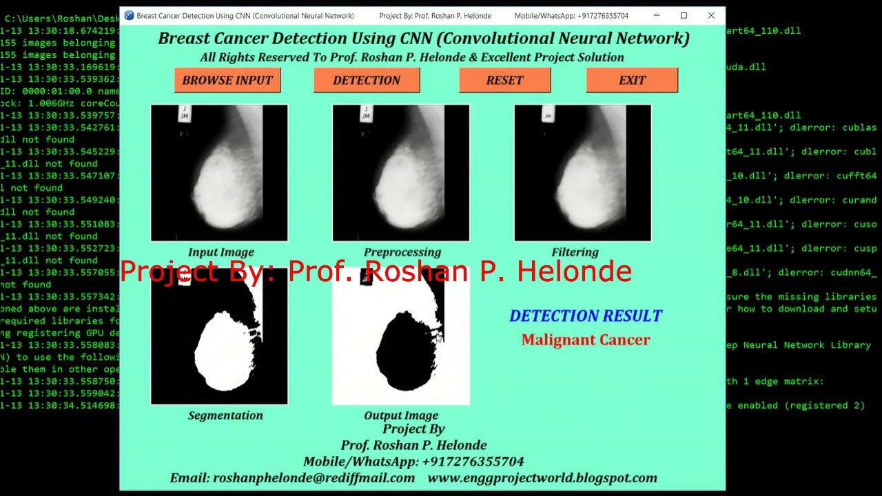 Breast Cancer Detection Using CNN Convolutional Neural Network | Python ...