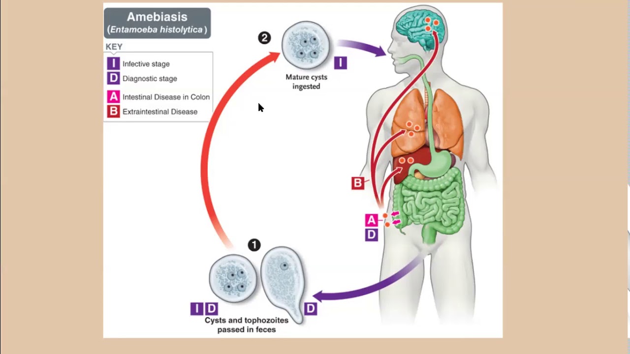 Amebiasis Intestinal 1 - YouTube
