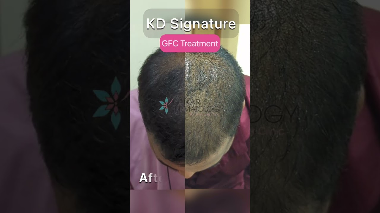Our KD Signature GFC treatments are an absolutely great way to restore ...