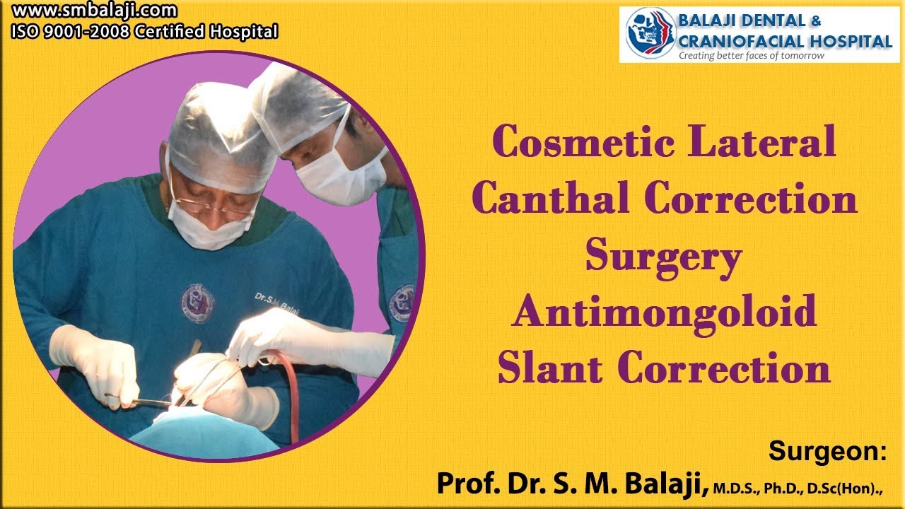 Cosmetic eye surgery with lateral canthopexy for antimongoloid slant ...