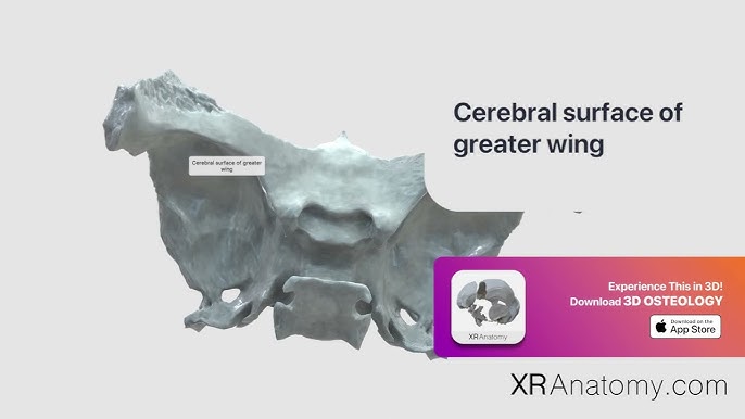 Greater Wing Of Sphenoid