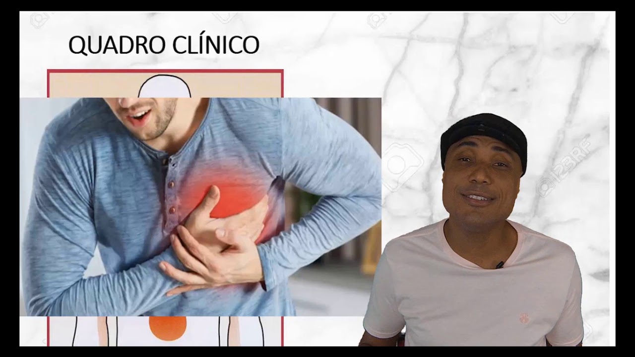 Característica da Dor de IAM e Sinal Clássico de Infarto Agudo do ...