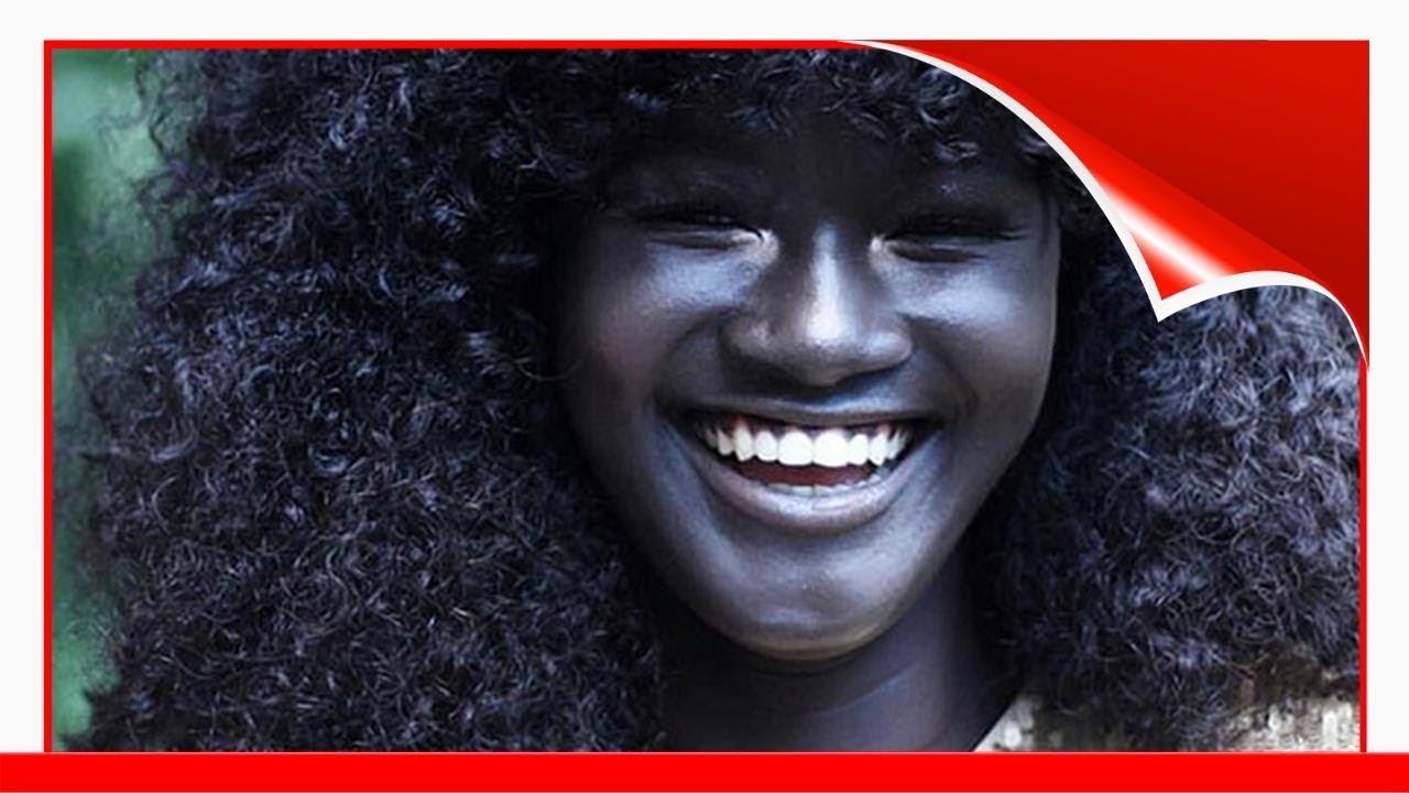 Teen Bullied For Her Incredibly Dark Skin Color Becomes A Model, Takes ...