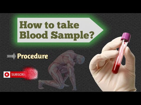 How to take blood sample || Biochemistry Practical || Harper ...