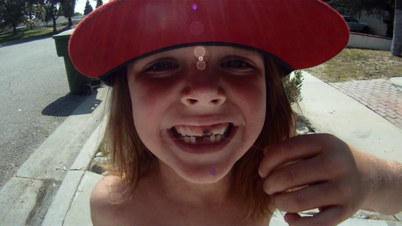 HONDA 50 DIRT BIKE RIPS OUT KIDS TOOTH!!!!!! - YouTube