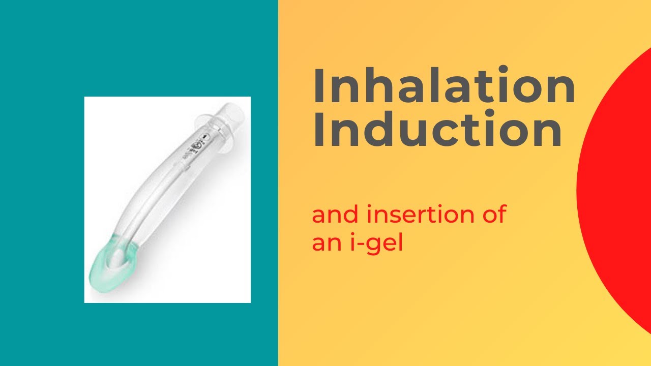 Inhalation Induction by Dr. Kapila Hettiarachchi - YouTube