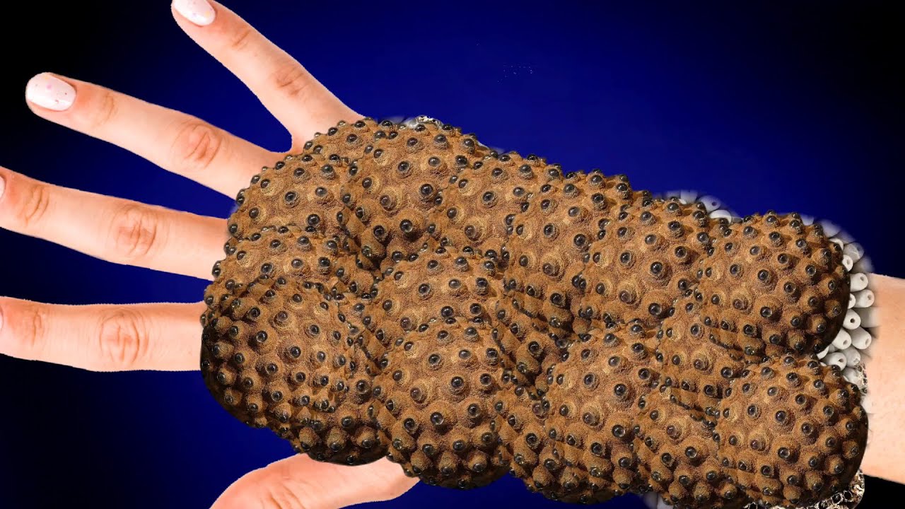 ASMR Hand Treatment | Remove Tick & Maggot From Hand | ASMR severely ...