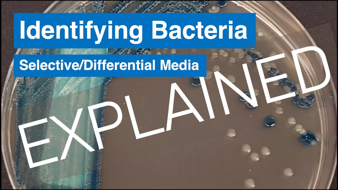 Selective And Differential Agar Explained YouTube selective-and-differential-agar-explained-youtube