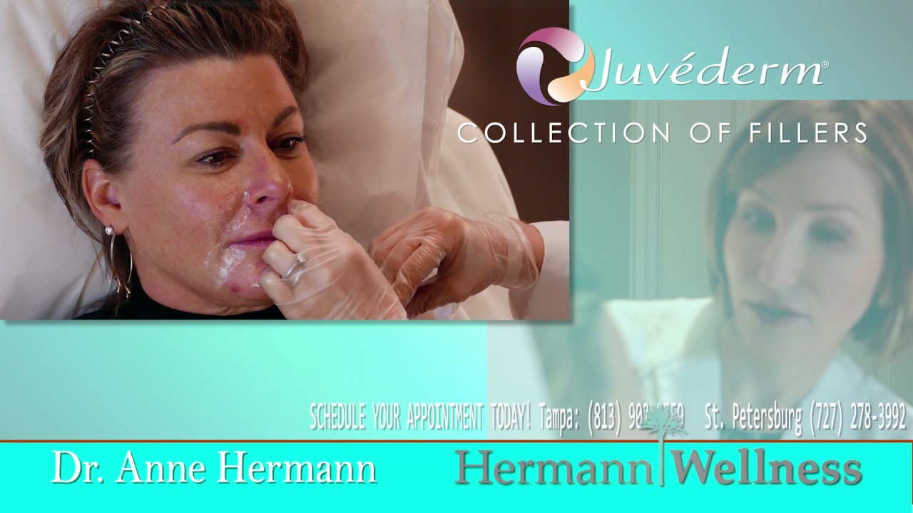 Juvederm Enlightenment at Hermann Wellness - YouTube