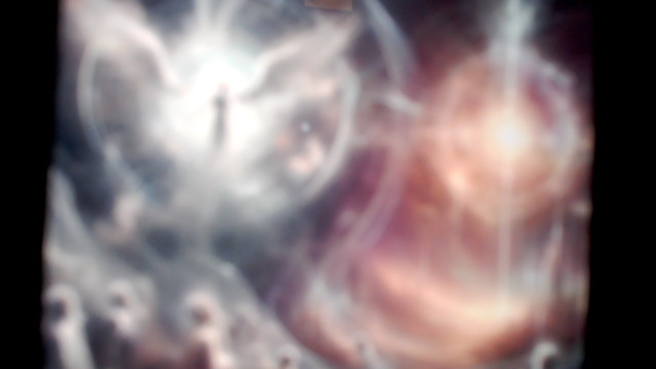 THE GOSPEL OF TWO RESURRECTIONS - YouTube