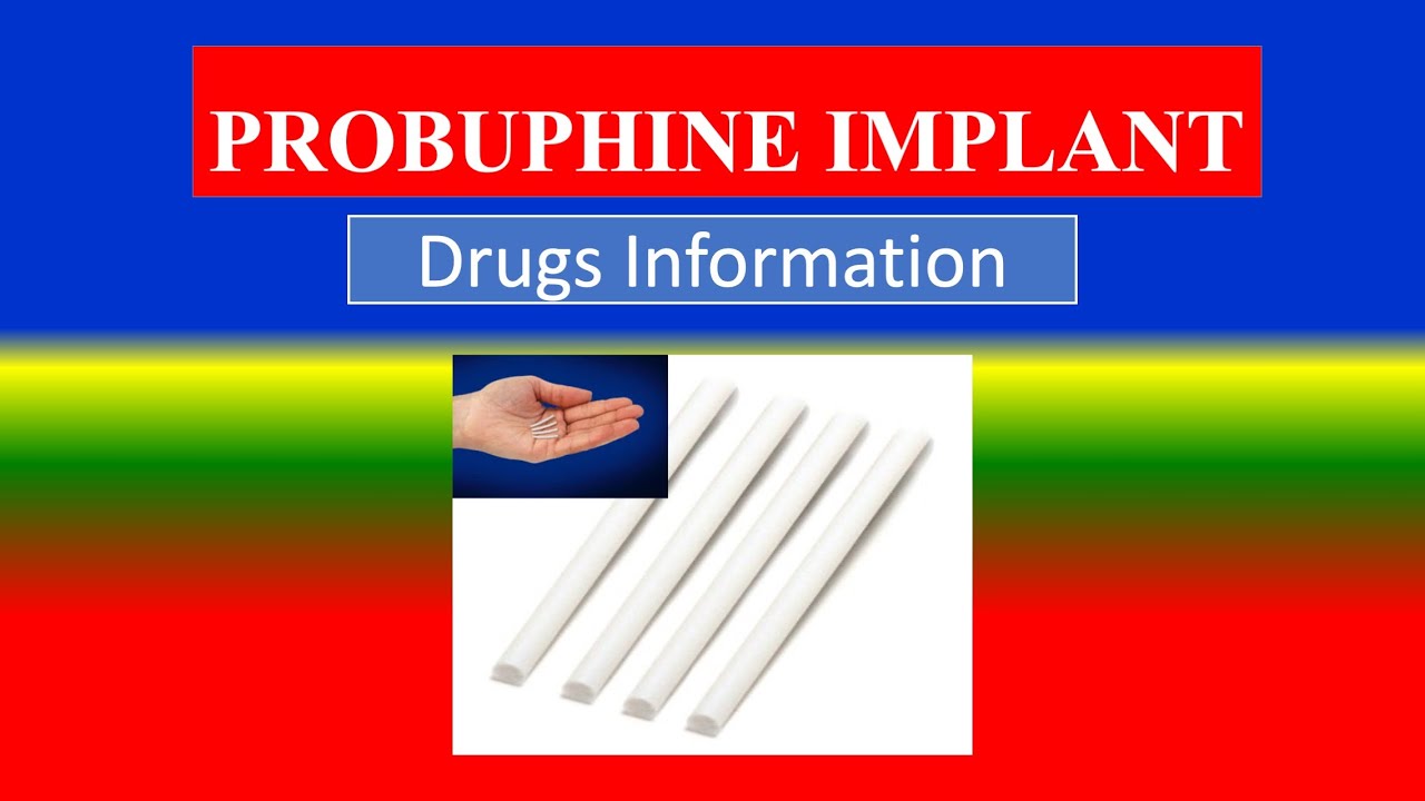 PROBUPHINE IMPLANT -Generic Name, Drug class, Brande Name ,Precautions ...