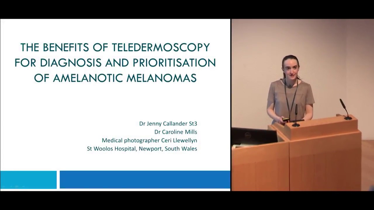 The benefits of teledermoscopy for diagnosis and prioritisation of ...