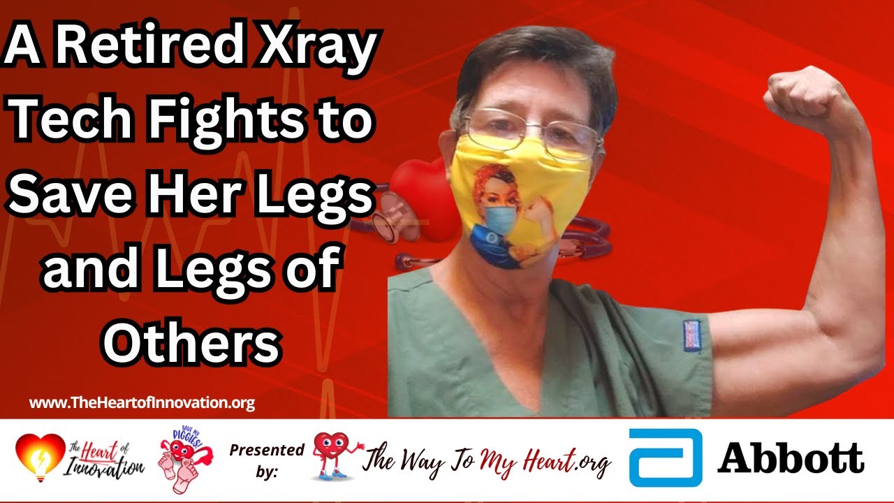 How A Retired Xray Tech is Saving Her Legs and Legs of Others - YouTube