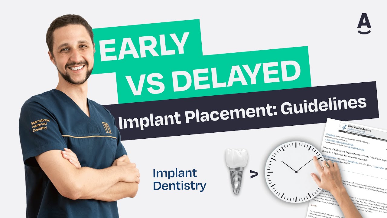 Early Vs Delayed Implant Placement: Guidelines - Implant Dentistry ...