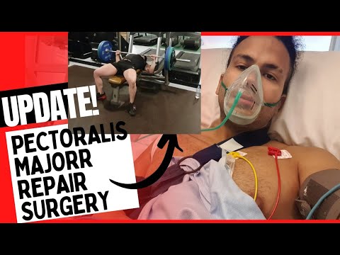 Pectoralis major repair surgery- Vlog 6 - YouTube