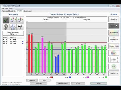 Virtual Electrodermal Screening TCM - YouTube