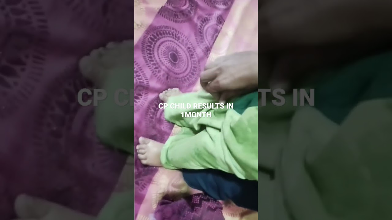 CP CHILD RESULTS IN 1 MONTH cp-child-results-in-1-month