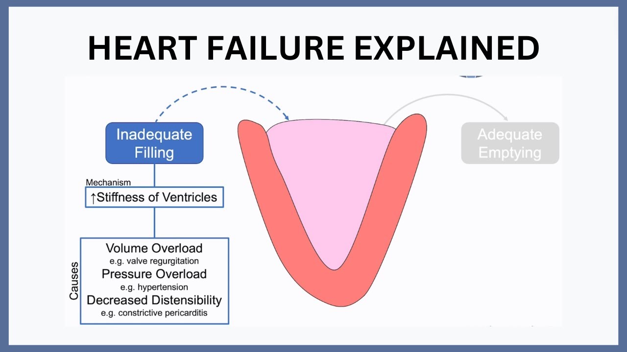 Heart Failure Explained - YouTube