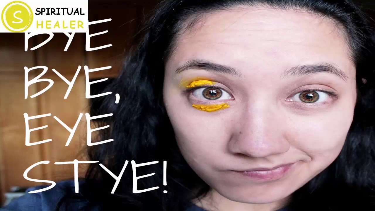 Cure For Eye Stye | Best Remedy For Eye Stye - YouTube
