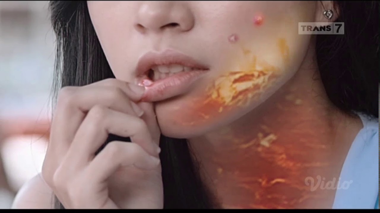 IKLAN Adem Sari Ching Ku, GAK ENAK BADAN, SARIAWAN, SAKIT TENGGOROKAN ...