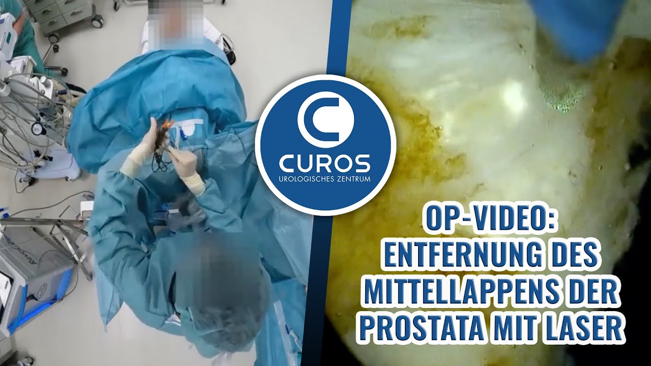 Entfernung des Mittellappens der Prostata mit Laser: So läuft die OP ab ...