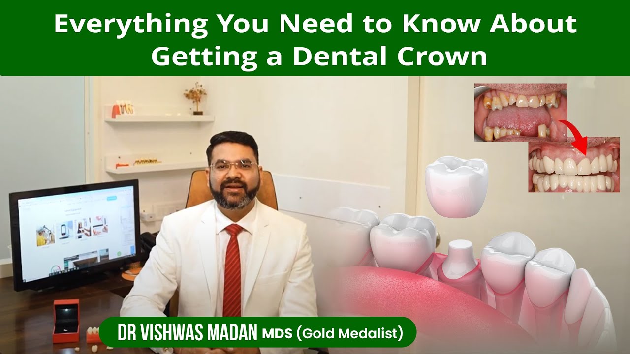 Everything You Need to Know About Getting a Dental Crown | Dental Crown ...