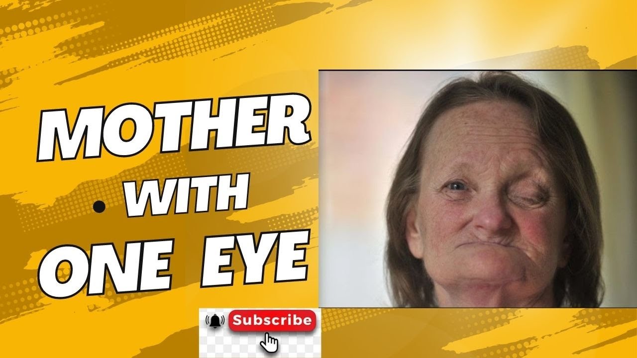 One Eye#Mother#mother with one Eye#Mother's Day#Prof. Tanvir Sadiq#Prof ...