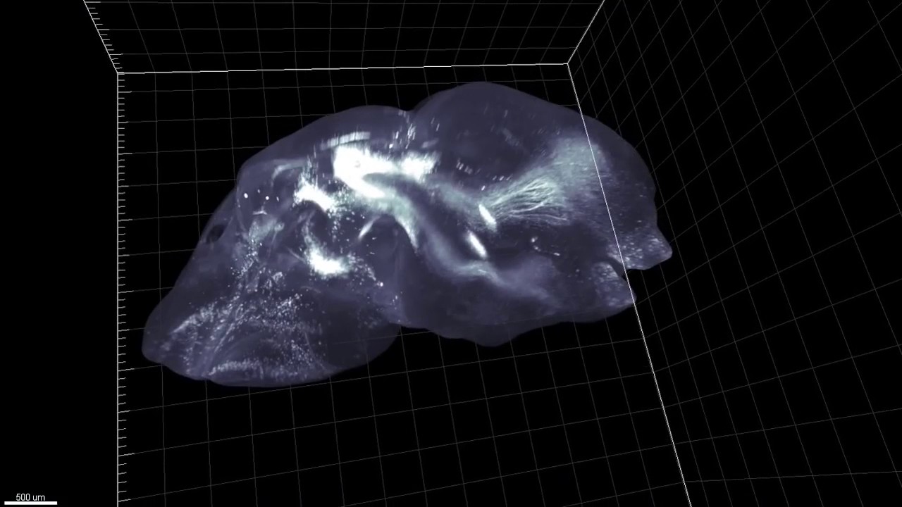 Tyrosine Hydroxylase staining of mice - YouTube