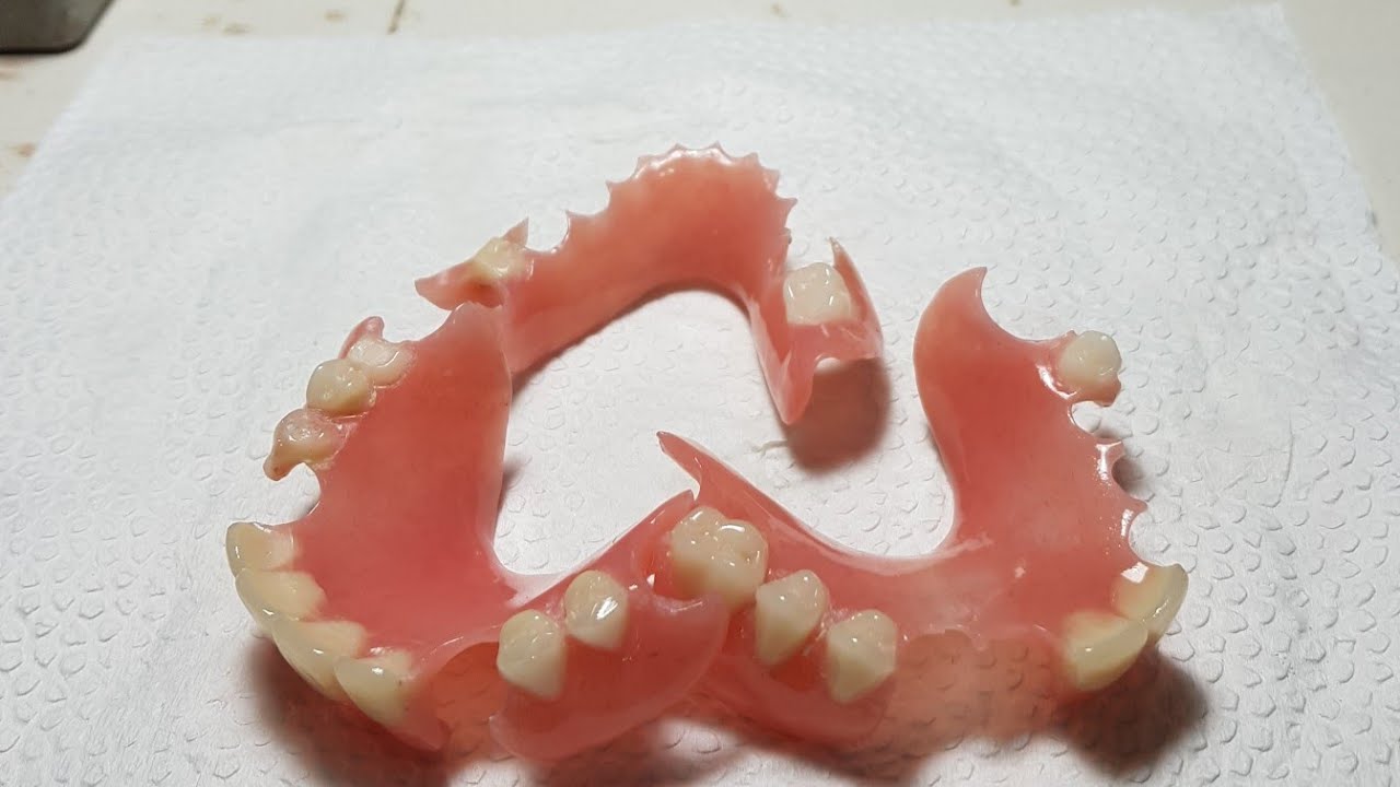 Trimming And Polishing Dentures at Cathy Remington blog