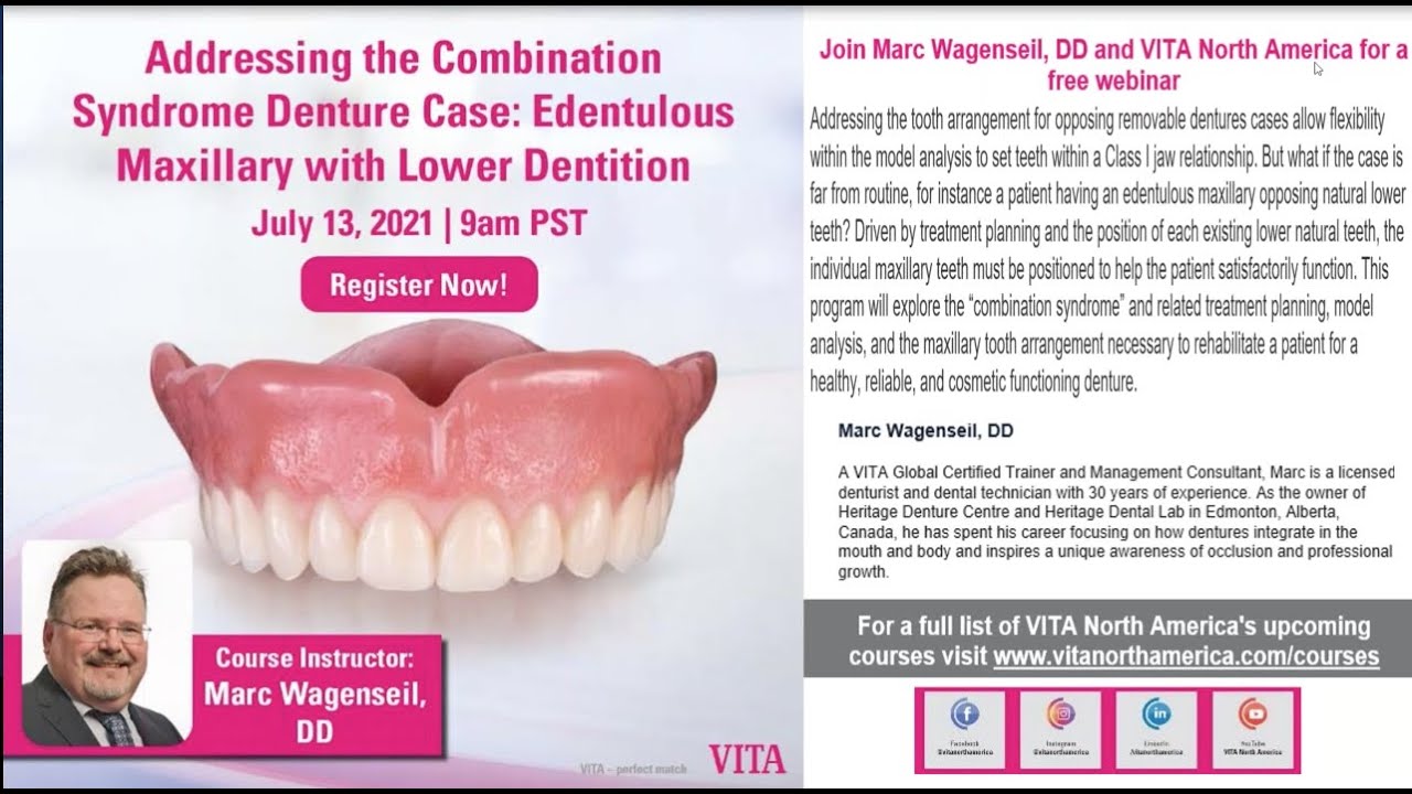 Addressing the Combination Syndrome Denture Case with Marc Wagenseil ...