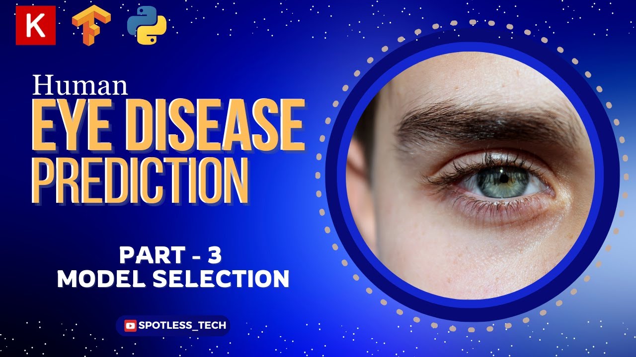 Human Eye Disease Prediction Part-3 | Keras Model Selection | Transfer Learning and Model ...