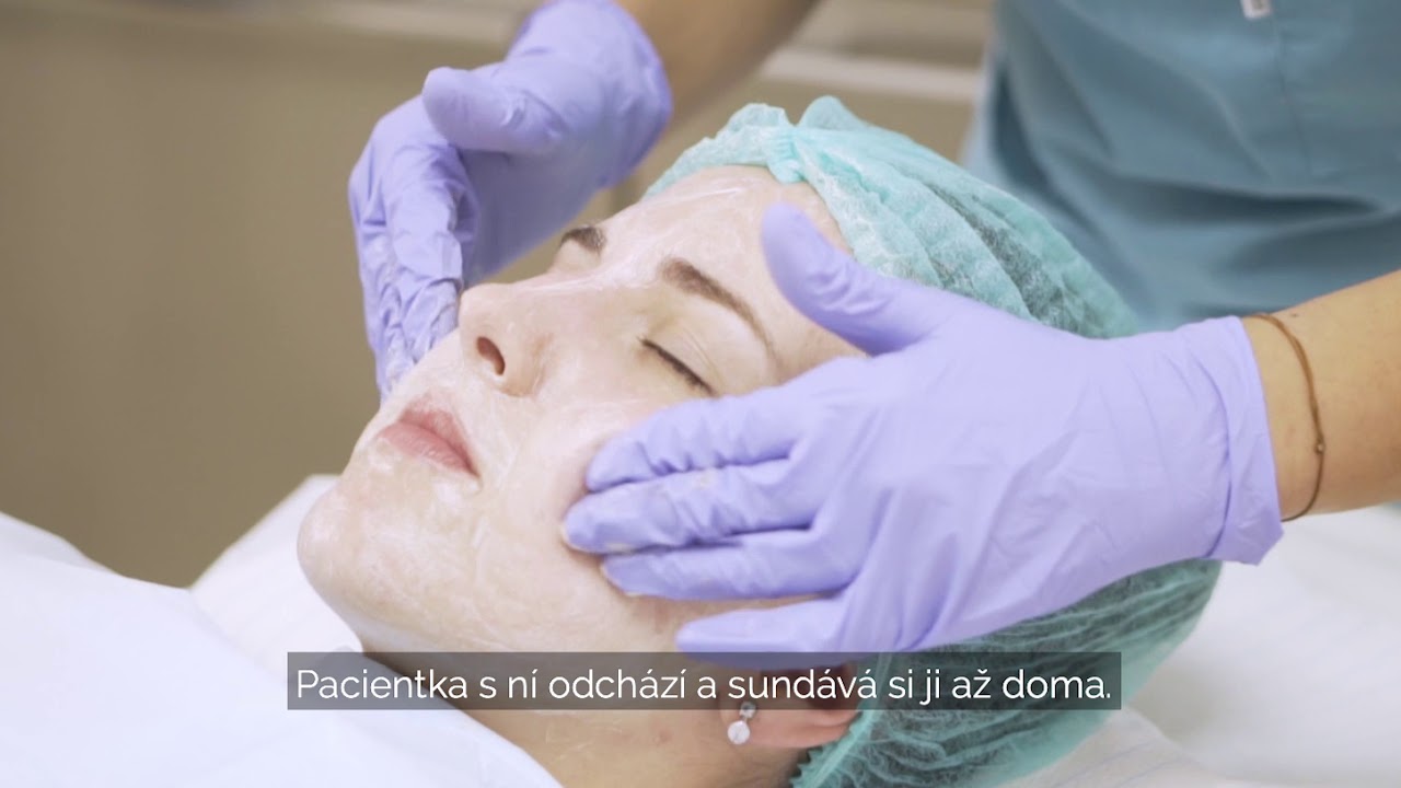Dermaestet Brno - Chemický peeling - YouTube