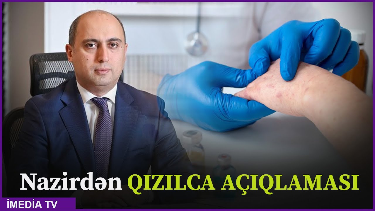 TƏCİLİ: Nazirdən QIZILCA AÇIQLAMASI: Məktəblər bağlanır? - CANLI YAYIM ...