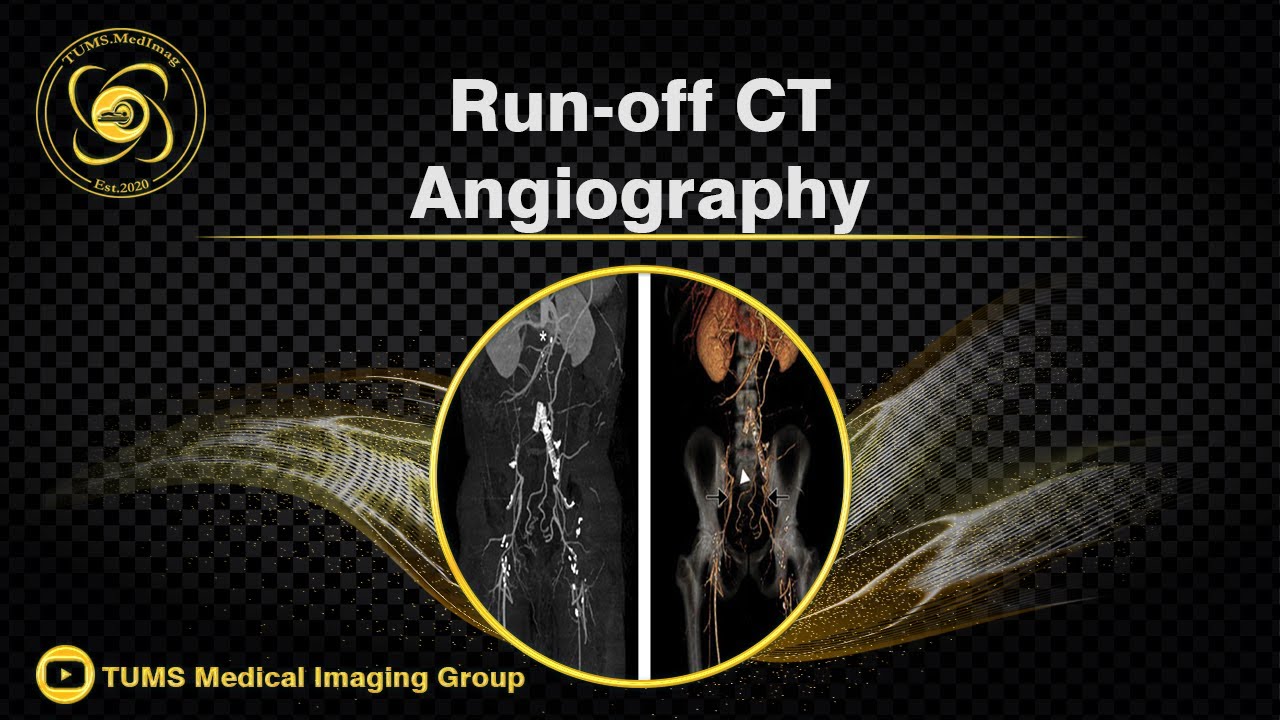 MedImag: Run-off computed tomography angiography (CTA) - YouTube