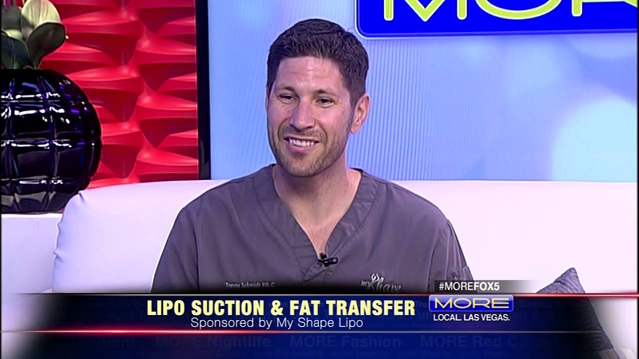 Trevor Schmidt PA-C of MyShape Lipo, Featured on Fox 5 More Show - YouTube