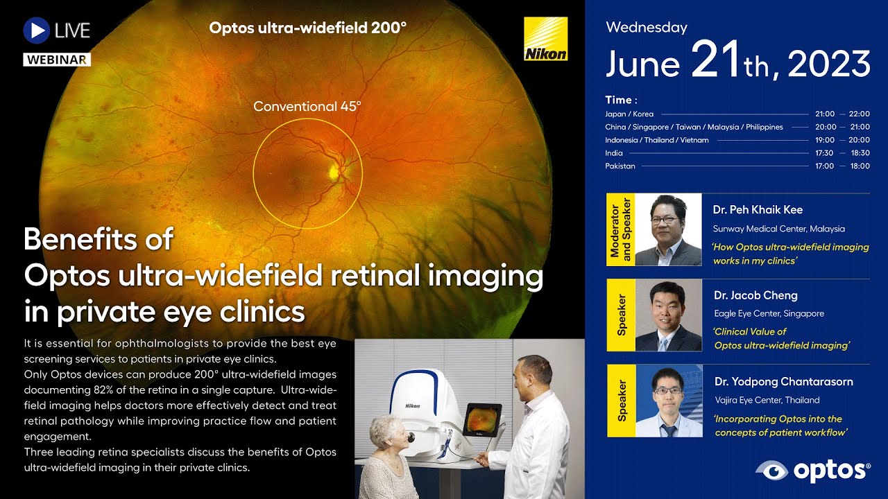Nikon-Optos Webinar "Benefits of Optos Ultra-Widefield Imaging in ...