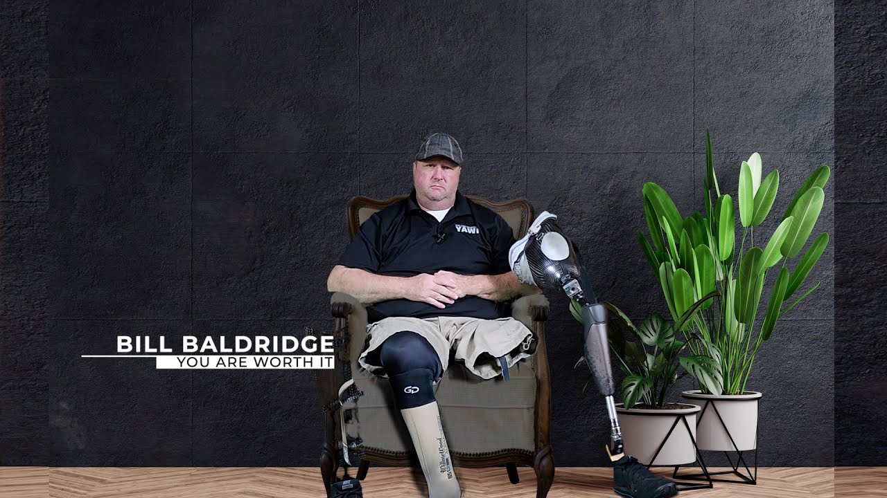 WHAT HAPPENED TO BILLY BOB NO-TOES LEGS??? WATCH THE TRUE STORY ...