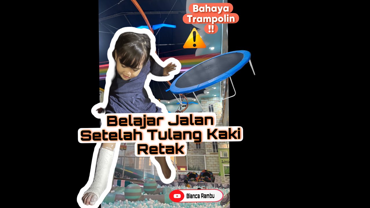 Belajar Jalan Setelah Tulang Kaki Retak | Bahaya Trampolin | Tulang ...