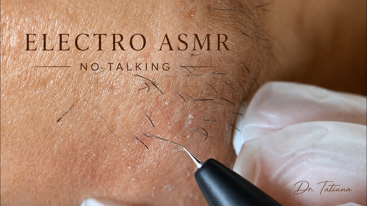 Macro Electrolysis ASMR | Real Hair Removal Procedure - YouTube