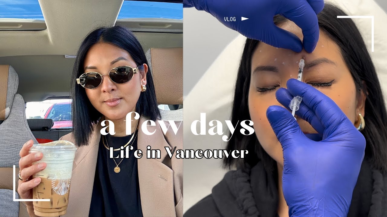 VLOG | SHOPPING & BOTOX FOR THE FIRST TIME - YouTube