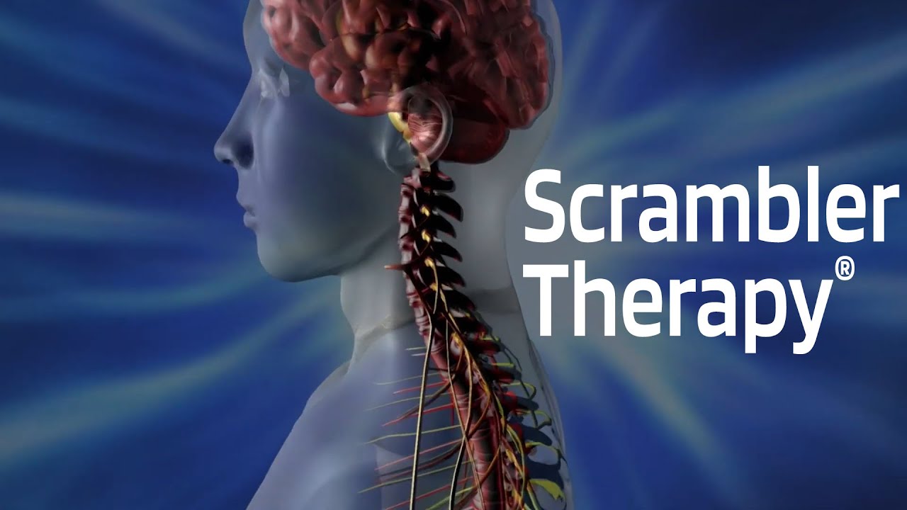 Scrambler Therapy - YouTube
