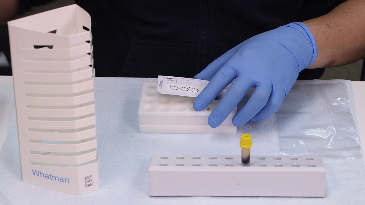 Preparing Dried Spot DS Collection Card with serum - YouTube