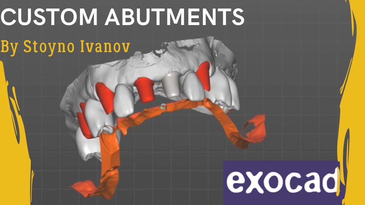 Fastest Exocad Video Tutorial - How To Design Custom Abutments - YouTube