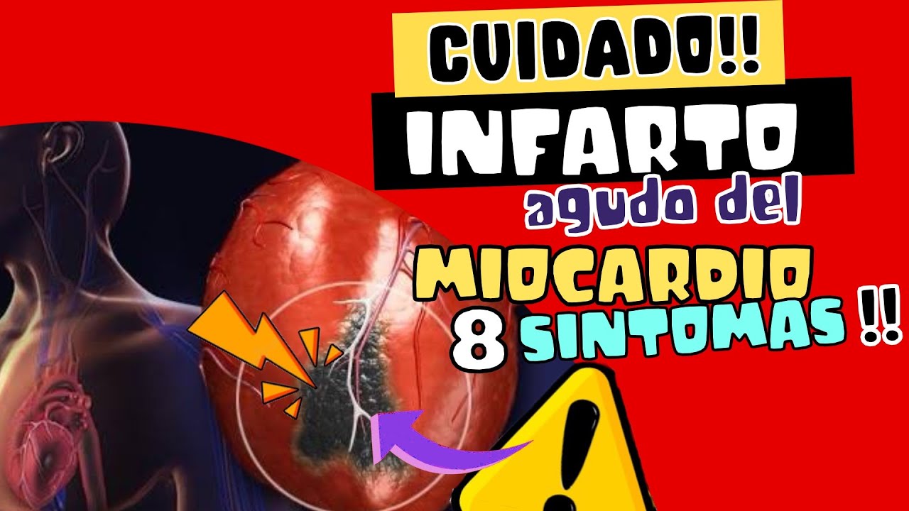 CUIDADO ⚠️ INFARTO AGUDO DE MIOCARDIO - 8 SÍNTOMAS A TOMAR ENC CUENTA ...