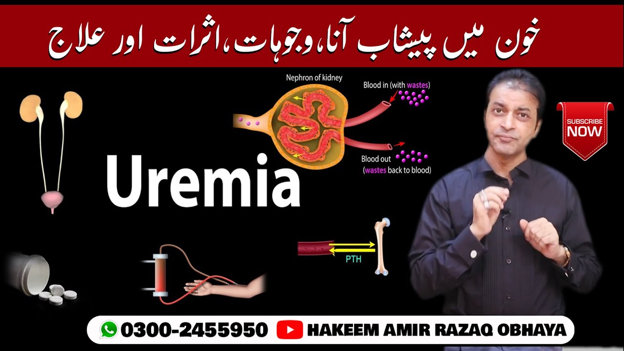 khoon mein peshab aana | Causes of Uremia, sign and symptoms of uremia ...