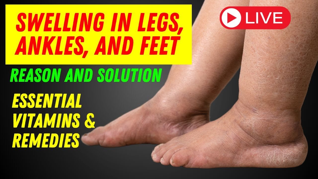 Swelling in Legs, Ankles, and Feet: Reason and Solution with Essential ...